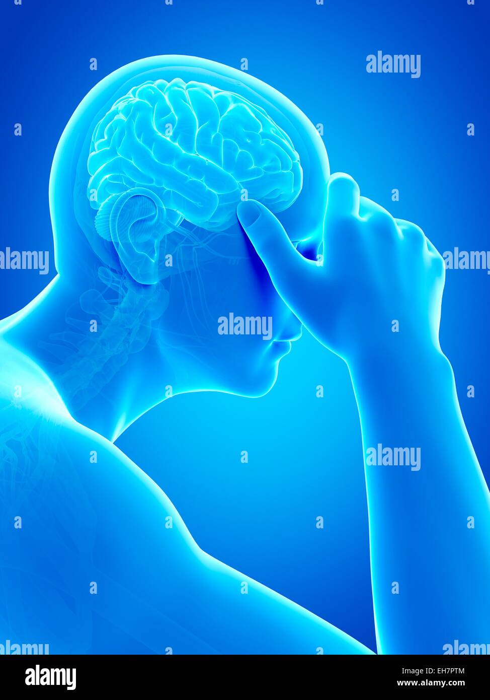 Human headache, illustration Stock Photo - Alamy