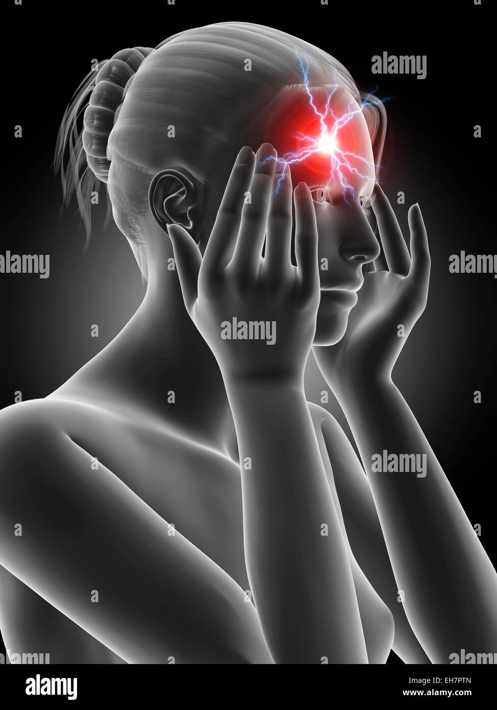Human headache, illustration Stock Photo - Alamy