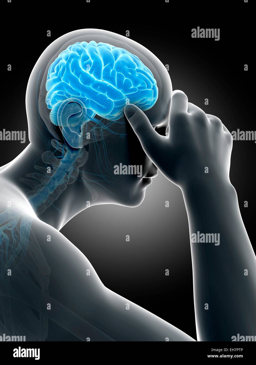 Human headache, illustration Stock Photo - Alamy