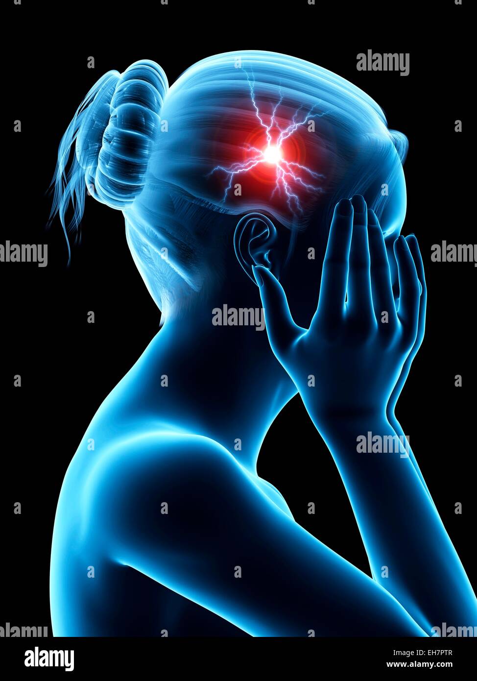 Human headache, illustration Stock Photo - Alamy