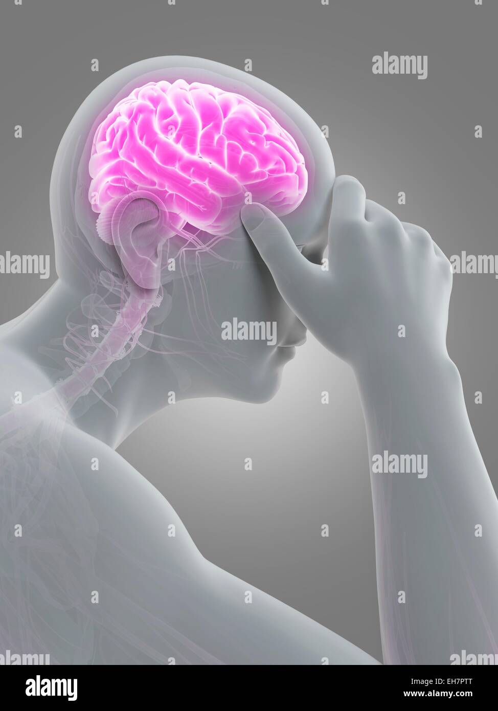 Human headache, illustration Stock Photo - Alamy