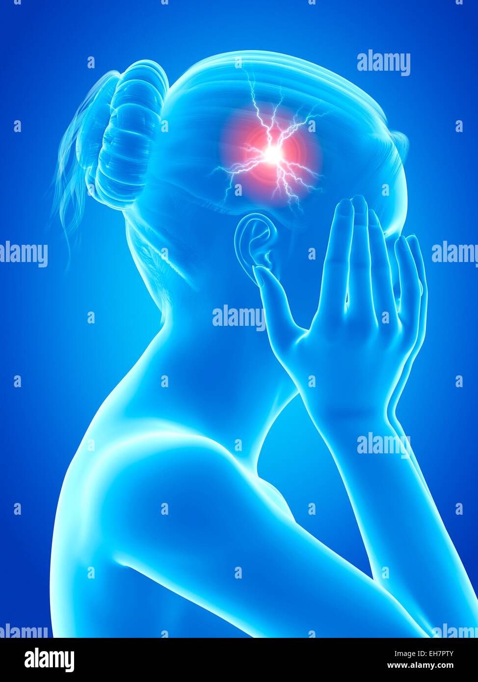 Human headache, illustration Stock Photo - Alamy