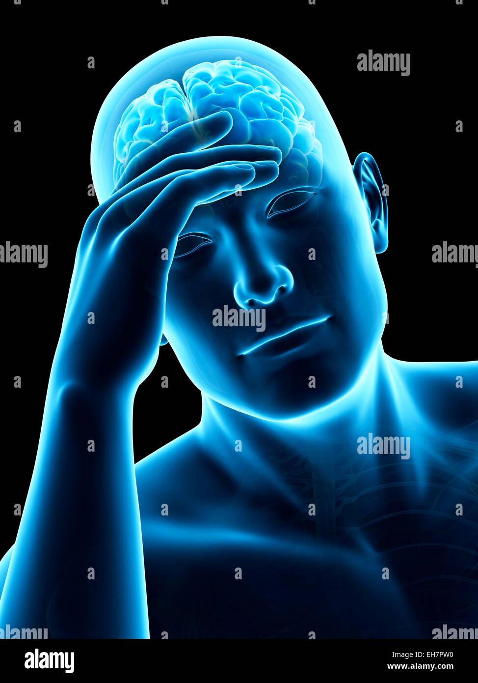 Human headache, illustration Stock Photo - Alamy