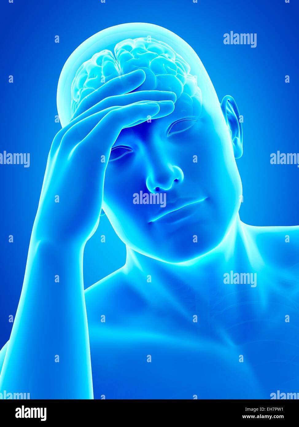 Human headache, illustration Stock Photo - Alamy