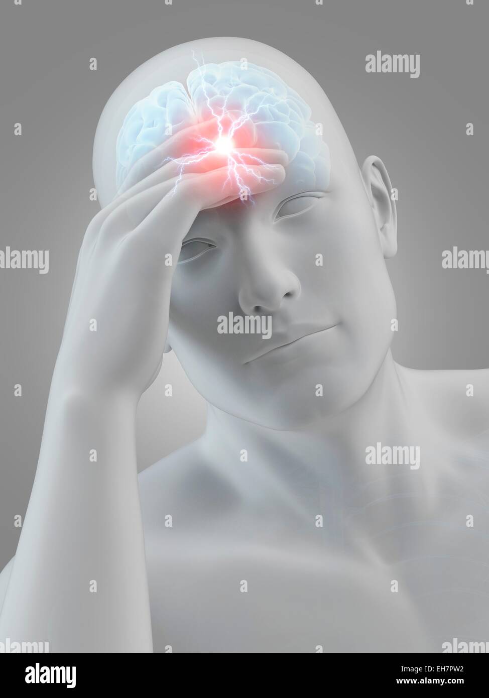 Human headache, illustration Stock Photo - Alamy