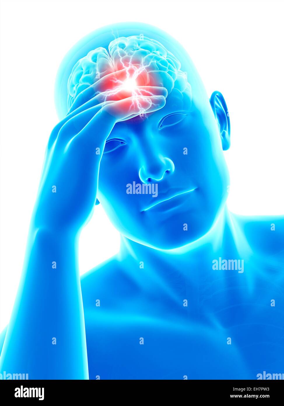 Human headache, illustration Stock Photo - Alamy
