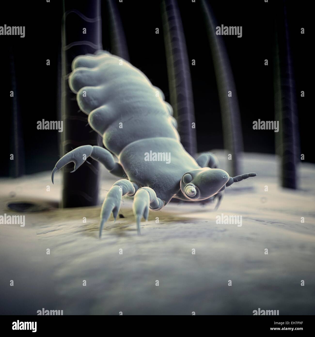 Head louse, illustration Stock Photo - Alamy