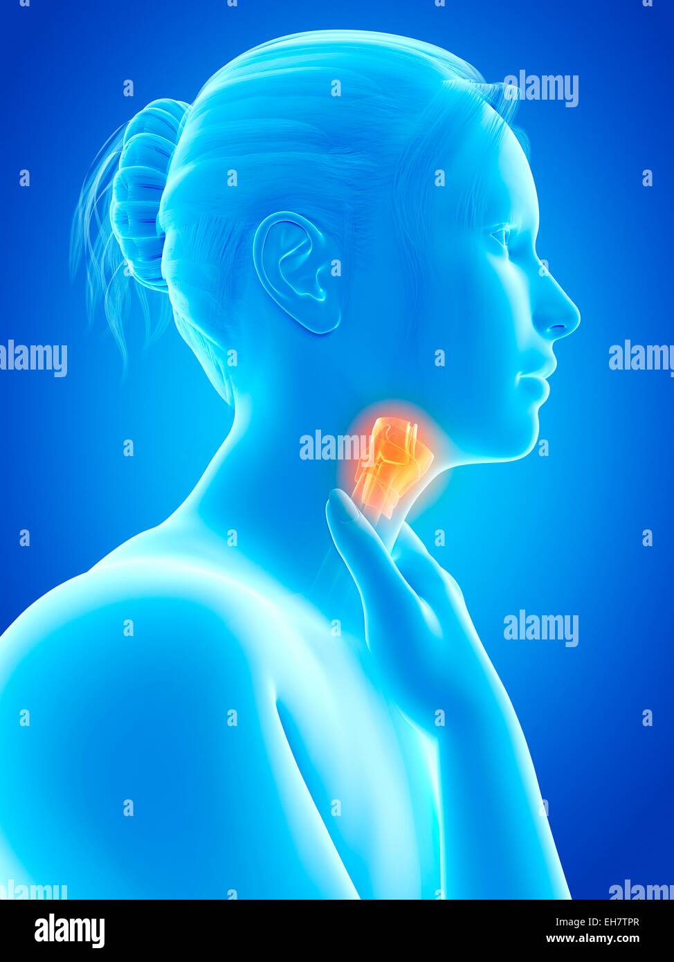 Inflammation of the larynx, illustration Stock Photo - Alamy