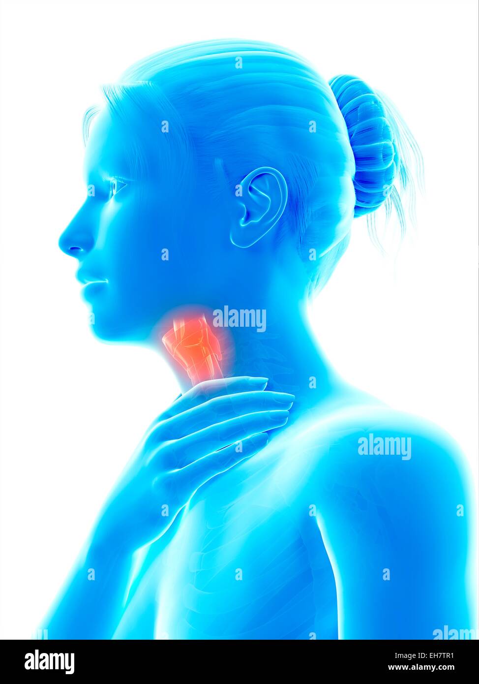 Inflammation of the larynx, illustration Stock Photo - Alamy
