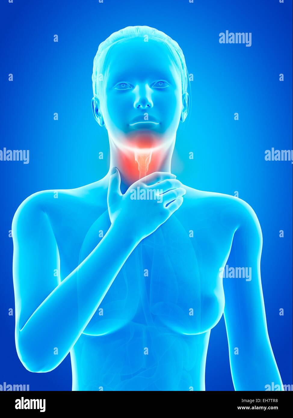 Inflammation Of The Larynx Stock Photos & Inflammation Of The Larynx ...