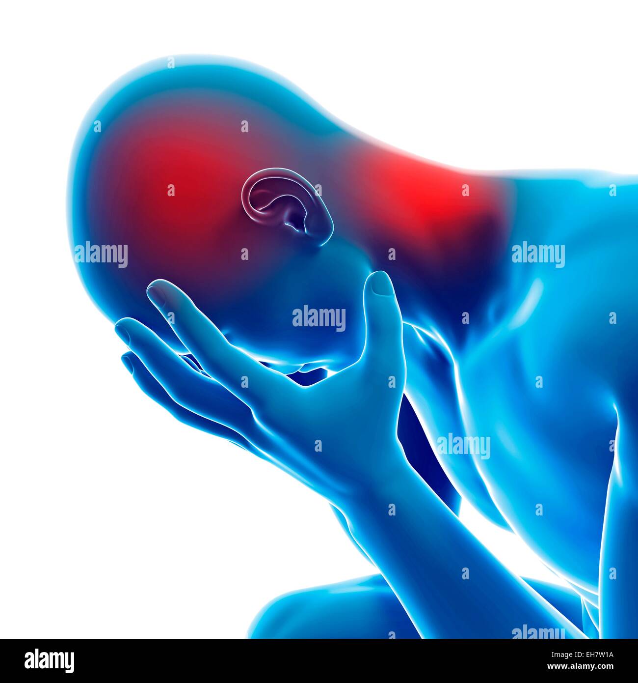 Human headache, illustration Stock Photo - Alamy