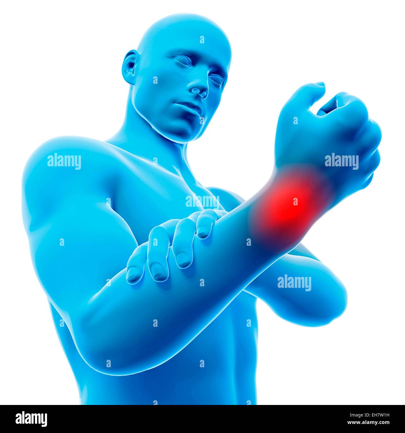 Human wrist pain, illustration Stock Photo - Alamy