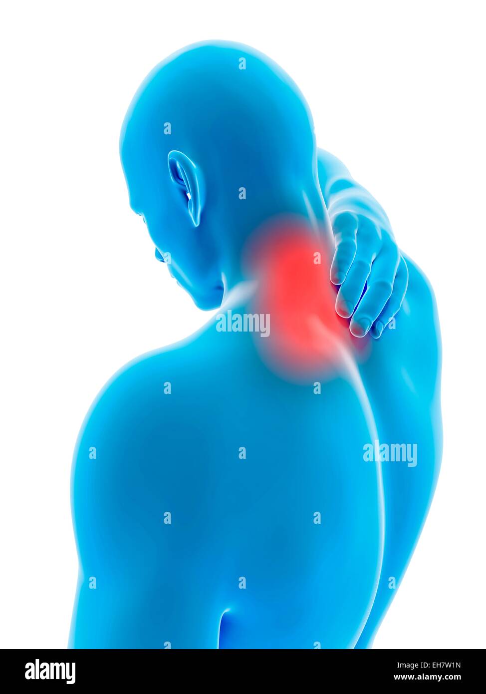 Human neck ache, illustration Stock Photo - Alamy