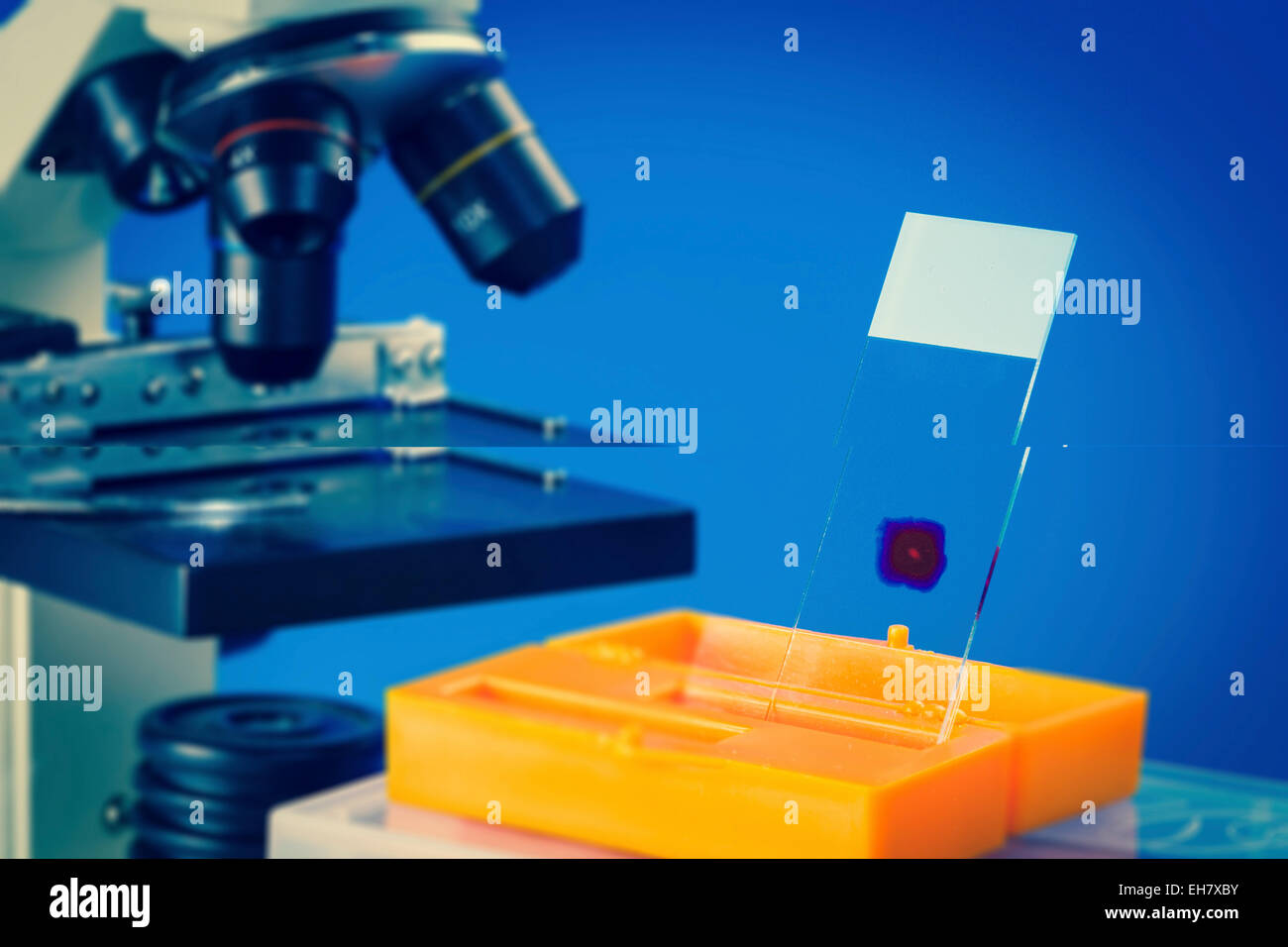 Microscope slide blue sample blood sample hi-res stock photography and ...