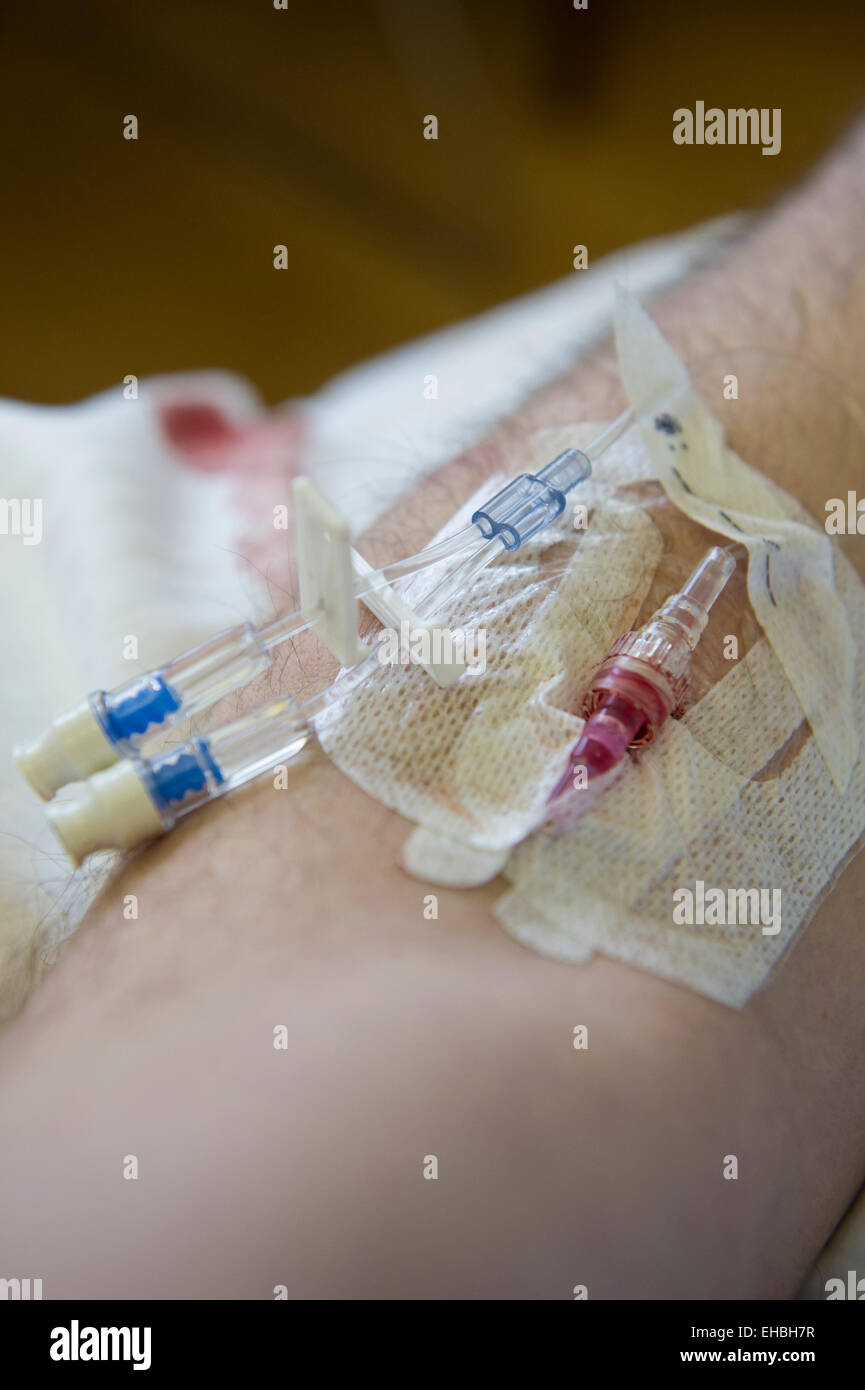 A man has a blood test in a hospital Stock Photo - Alamy