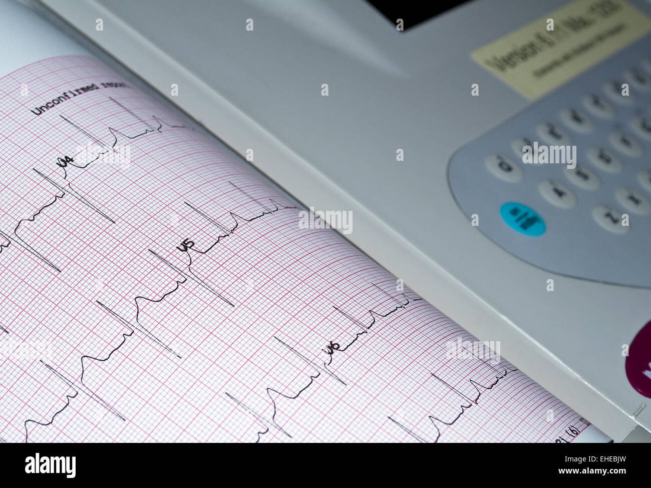 Electrocardiogram hi-res stock photography and images - Alamy