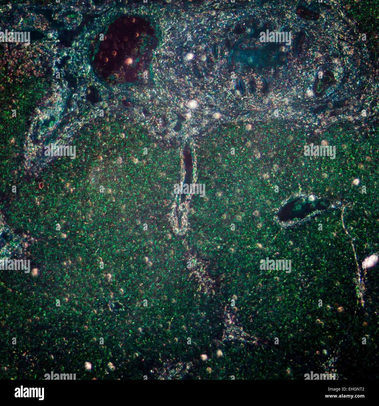 Liver cells micrograph hi-res stock photography and images - Alamy