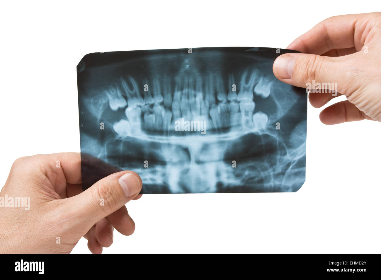 X ray hand hi-res stock photography and images - Alamy