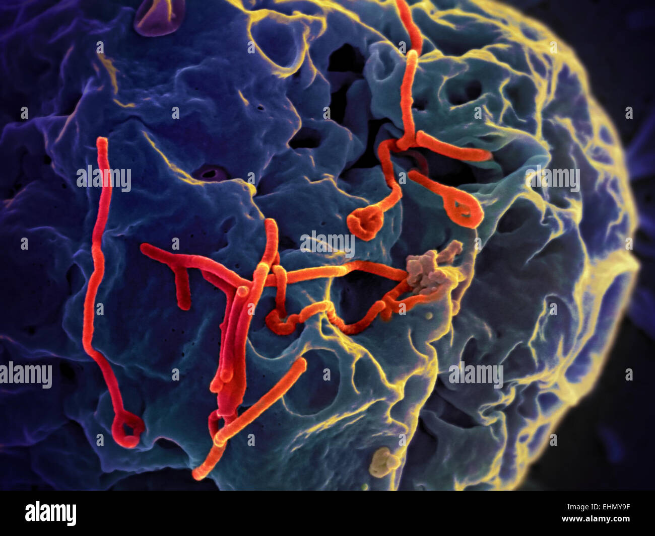 Coloured scanning electron micrograph (SEM) of ebola virus particles ...
