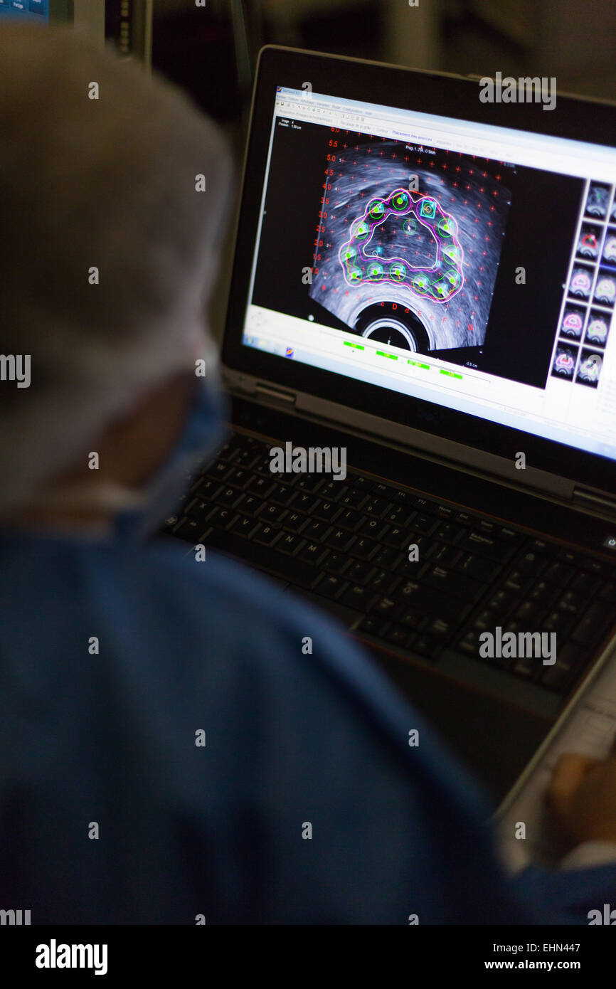 Prostate cancer radiotherapy surgery. Radiologist inserting a hollow ...