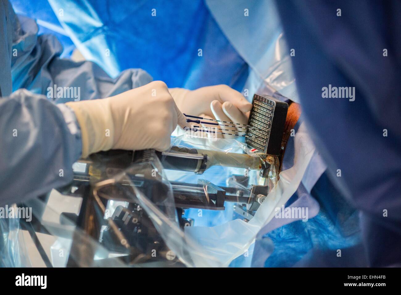 Brachytherapy hi-res stock photography and images - Alamy