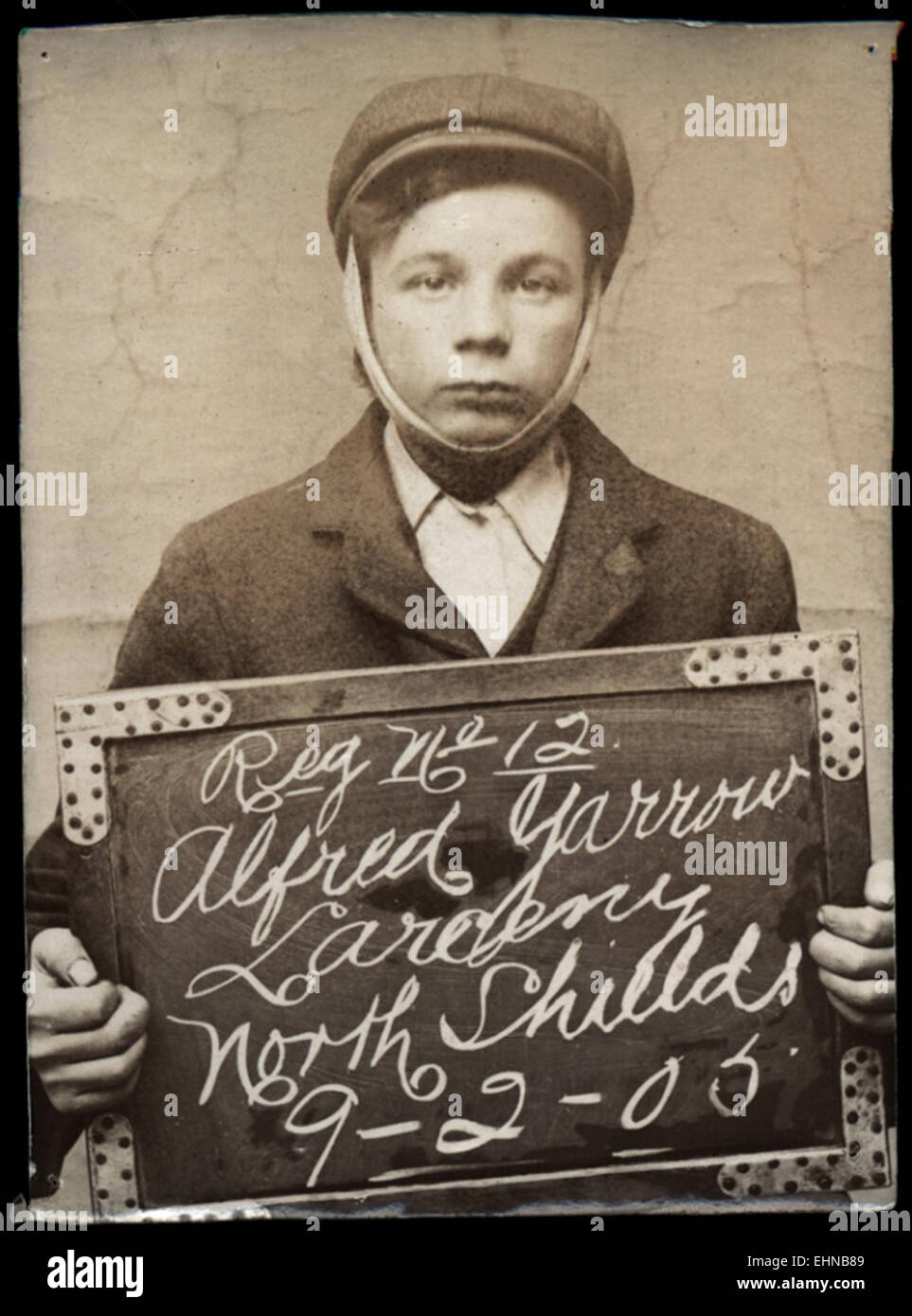 Eye injury historic hi-res stock photography and images - Alamy