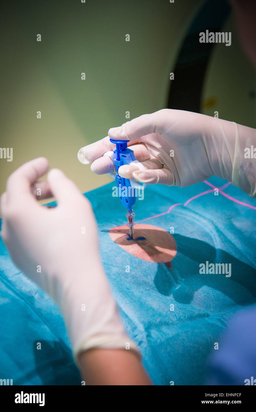 Kidney biopsy hi-res stock photography and images - Alamy