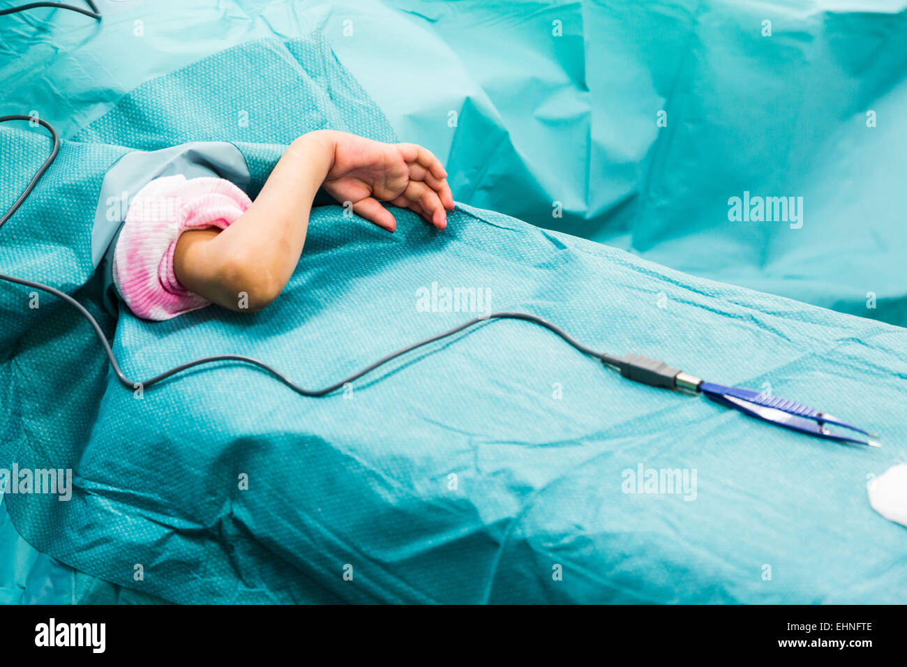 Surgery arthrolysis elbow, bipolar forceps ( right ) Jouvenet clinic ...