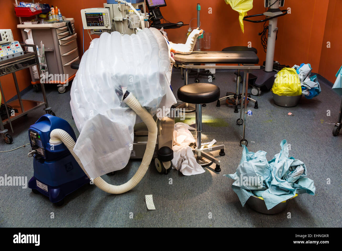 Laying a cast after hand surgery Stock Photo - Alamy