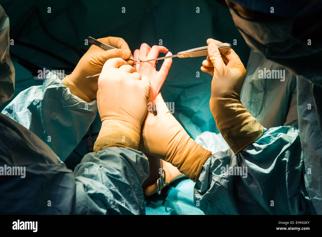 Hand surgery hi-res stock photography and images - Alamy