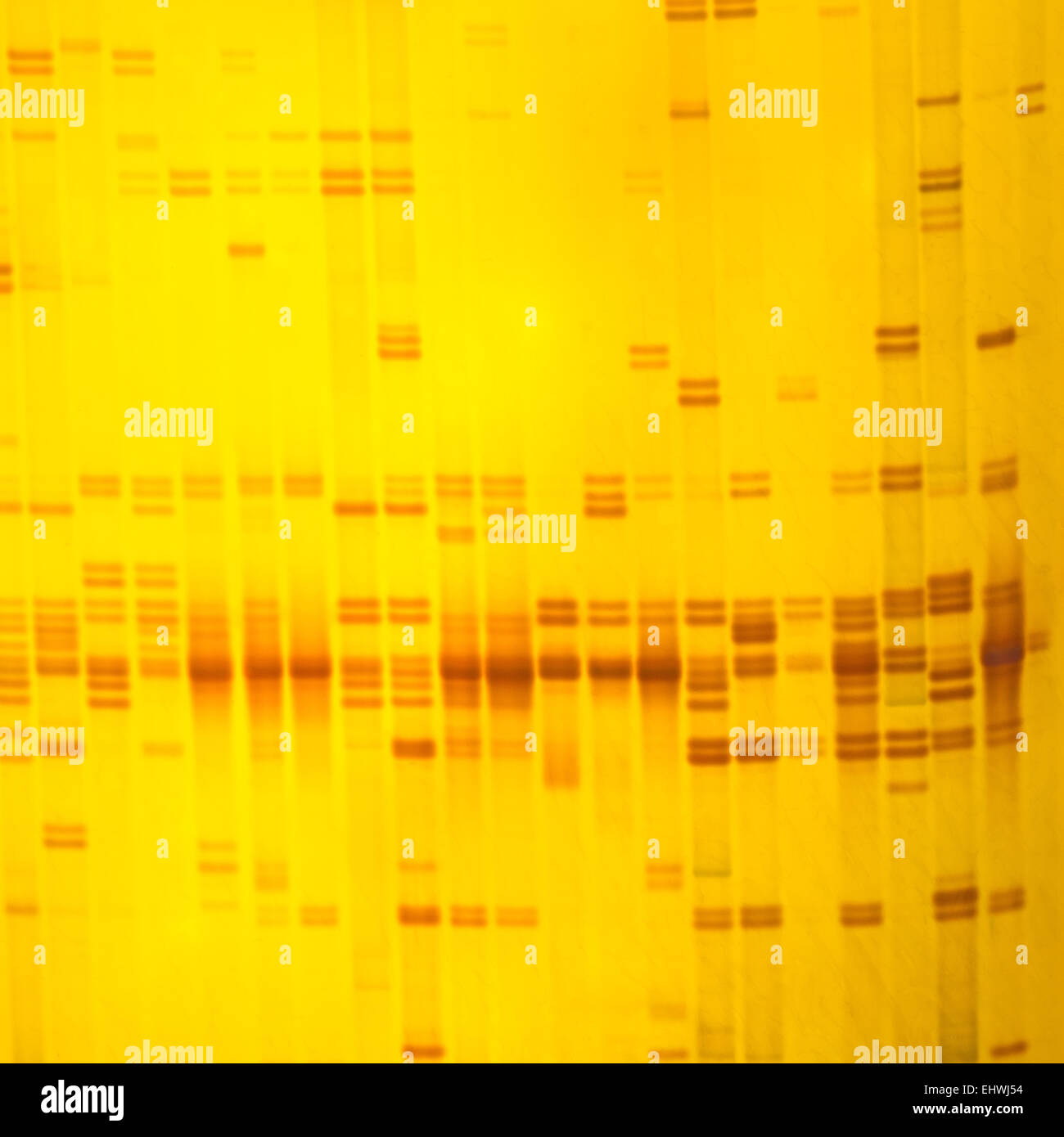 Plant DNA fingerprint on acrylamine gel electrophoresis result Stock ...