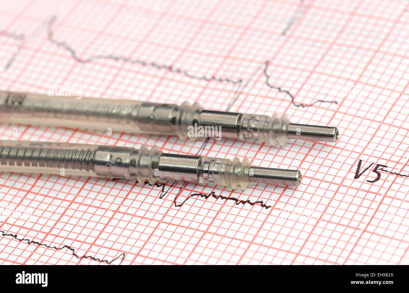 Close up of Pacemaker leads on electrocardiograph Stock Photo - Alamy