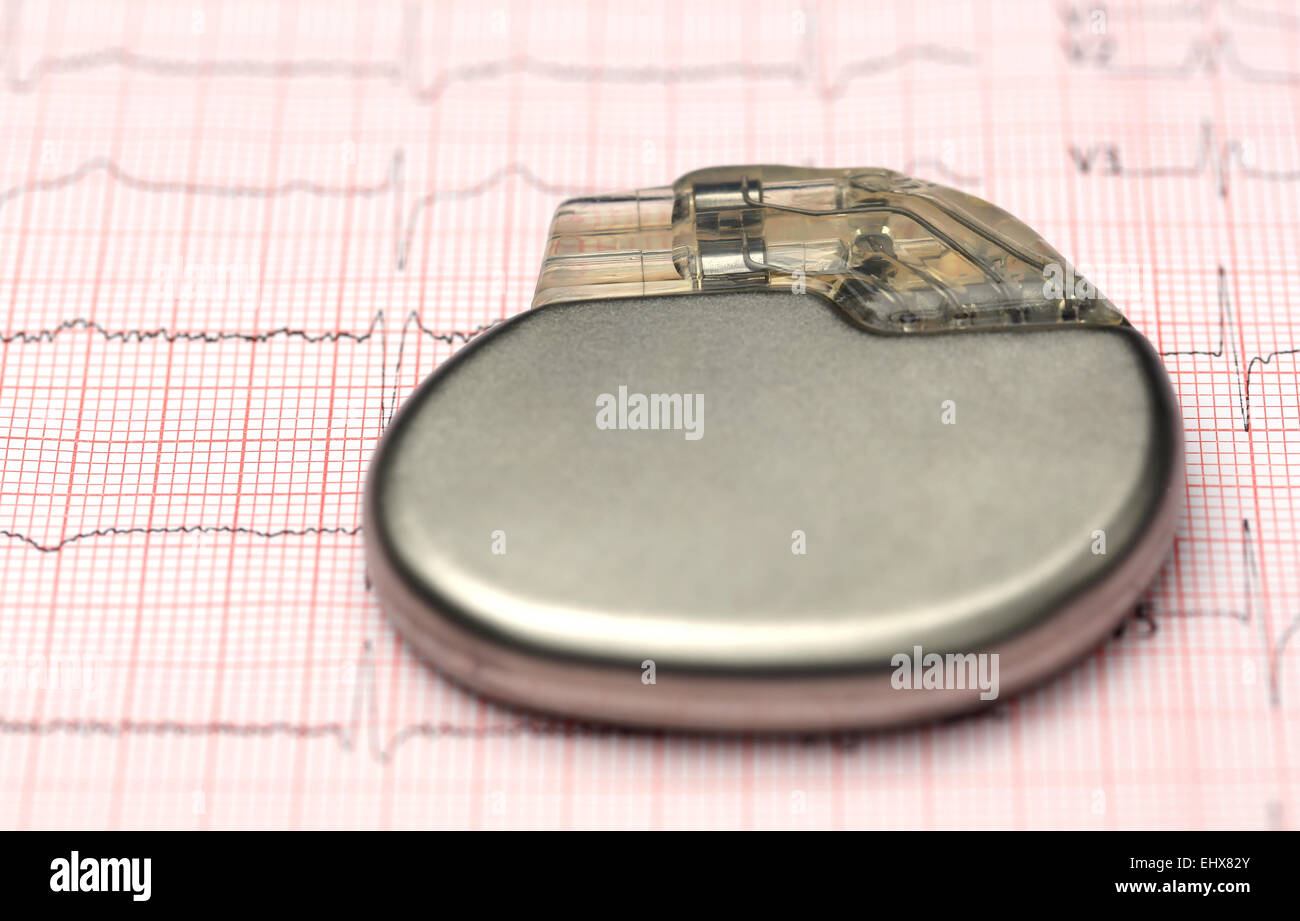 Close up of Pacemaker on electrocardiograph Stock Photo - Alamy