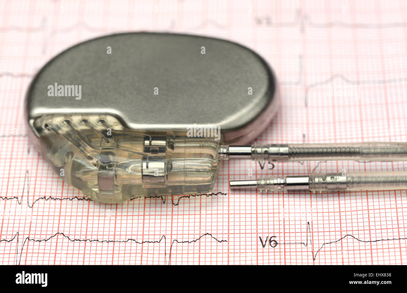 Pace maker hi-res stock photography and images - Alamy