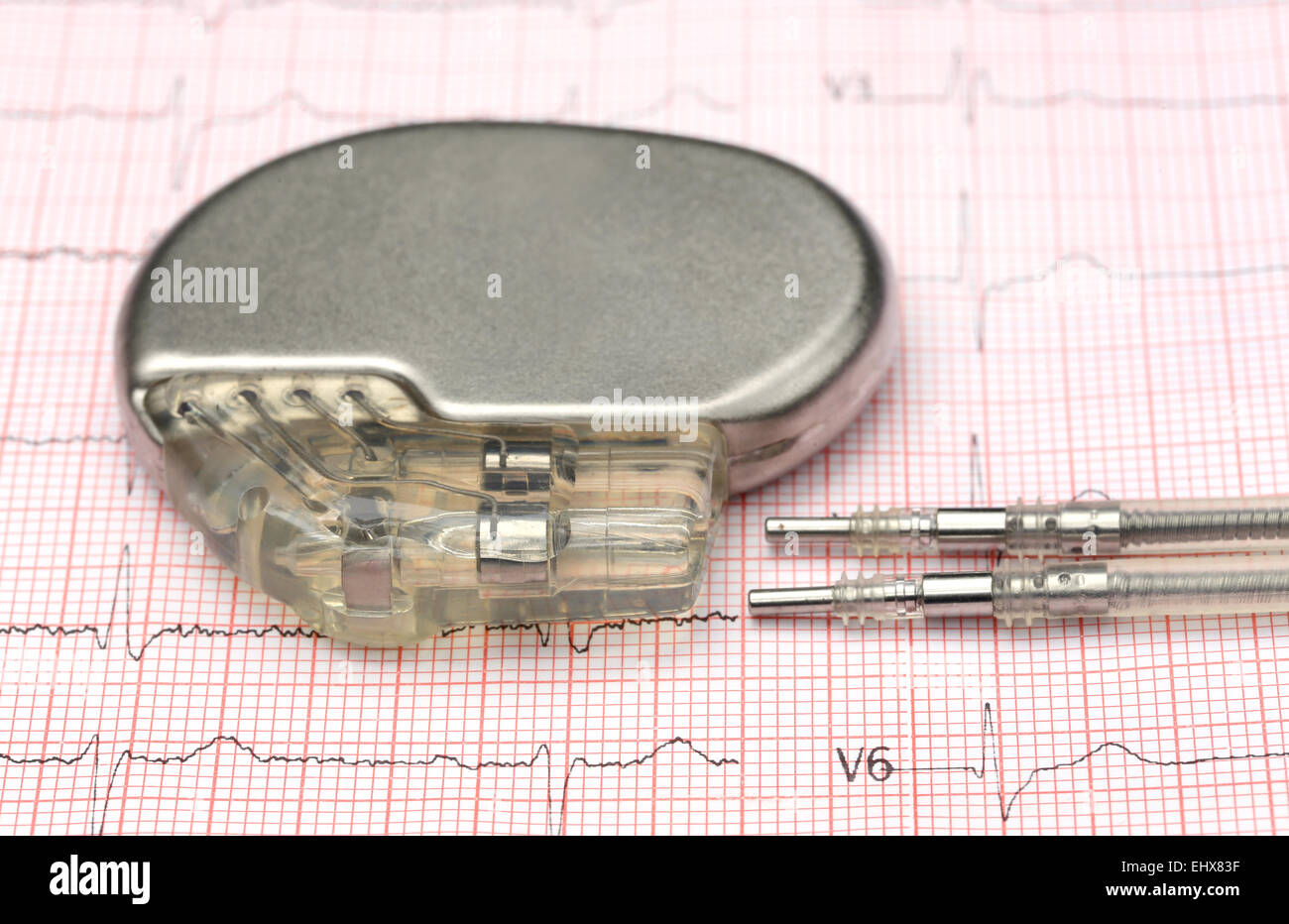 Close up of pacemaker on electrocardiograph Stock Photo - Alamy