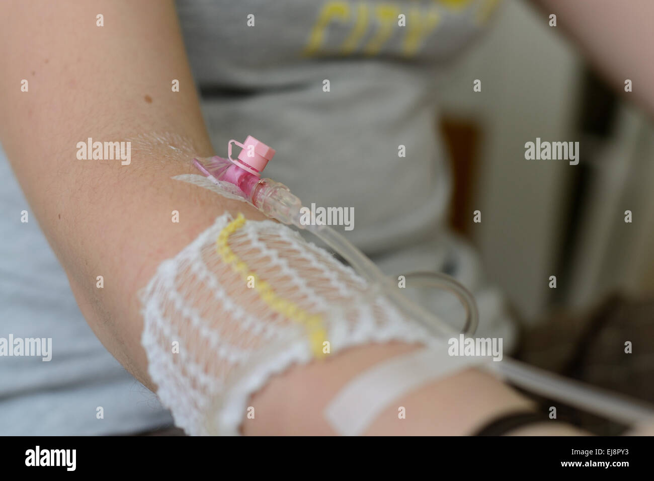 Venenverweilkatheter hi-res stock photography and images - Alamy