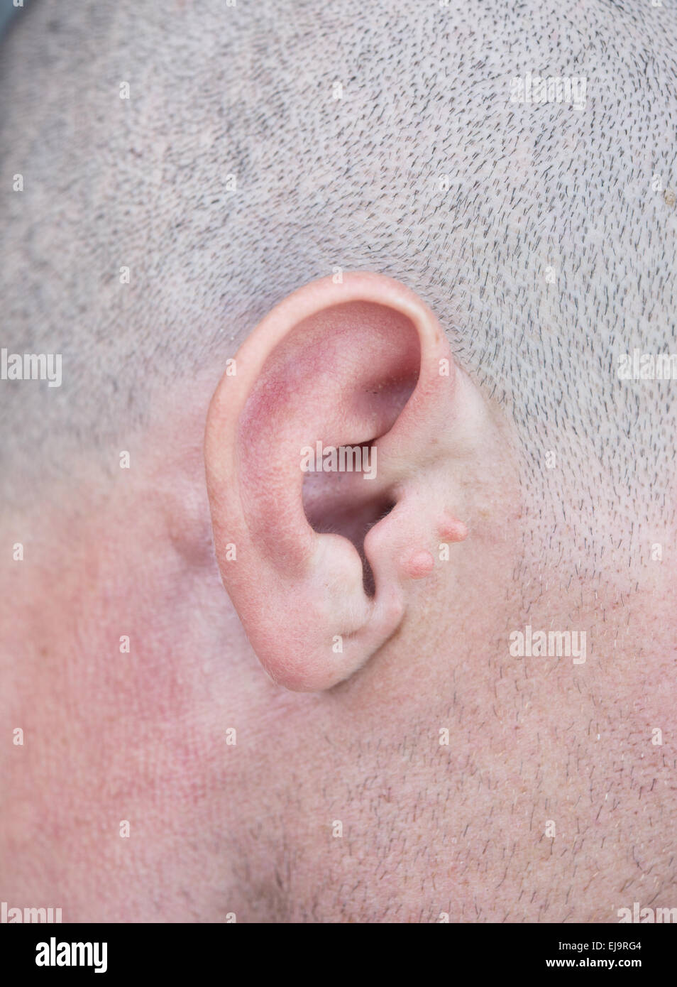 Rear head with ear hi-res stock photography and images - Alamy