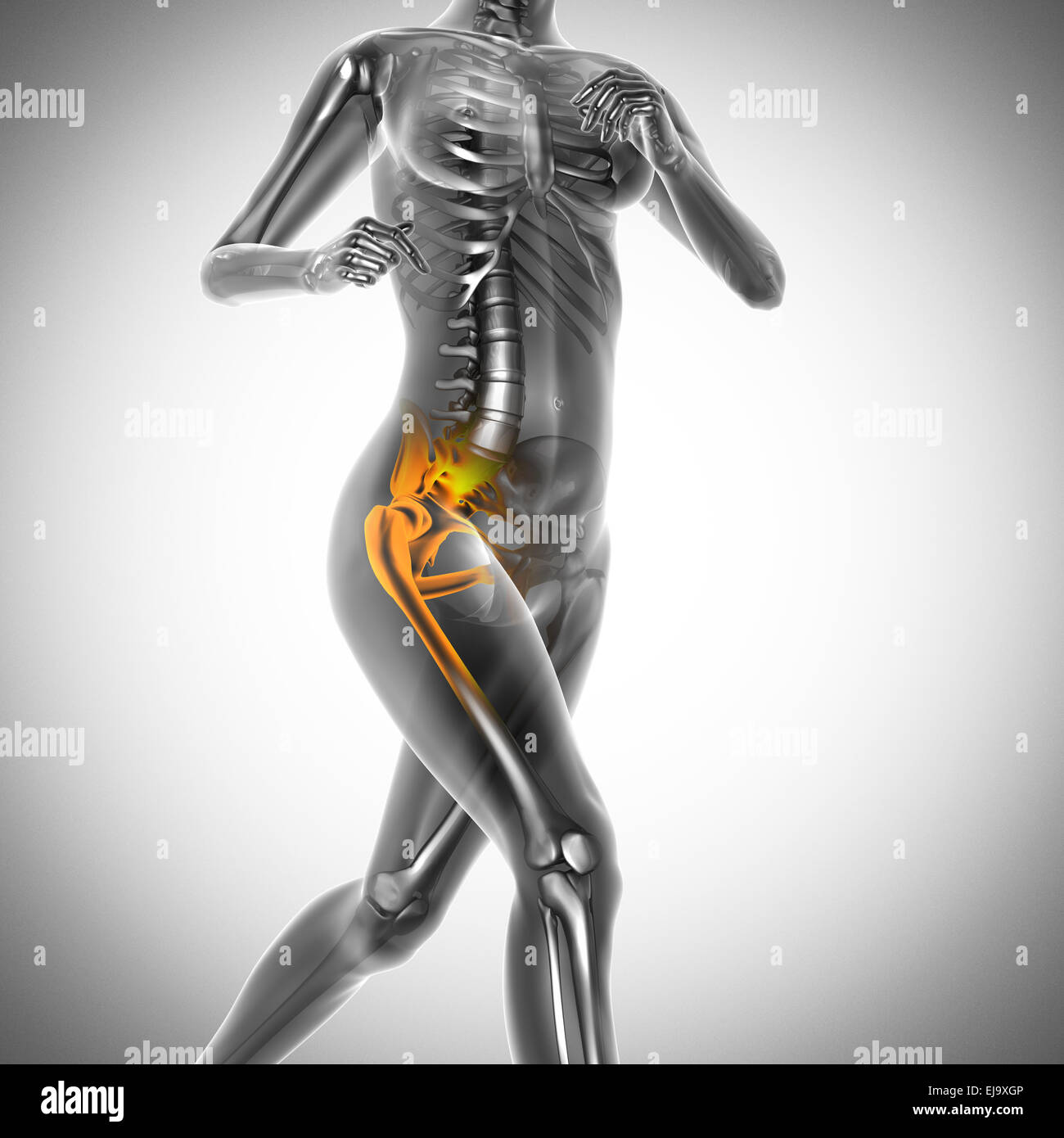 Image of osteoporosis hi-res stock photography and images - Alamy