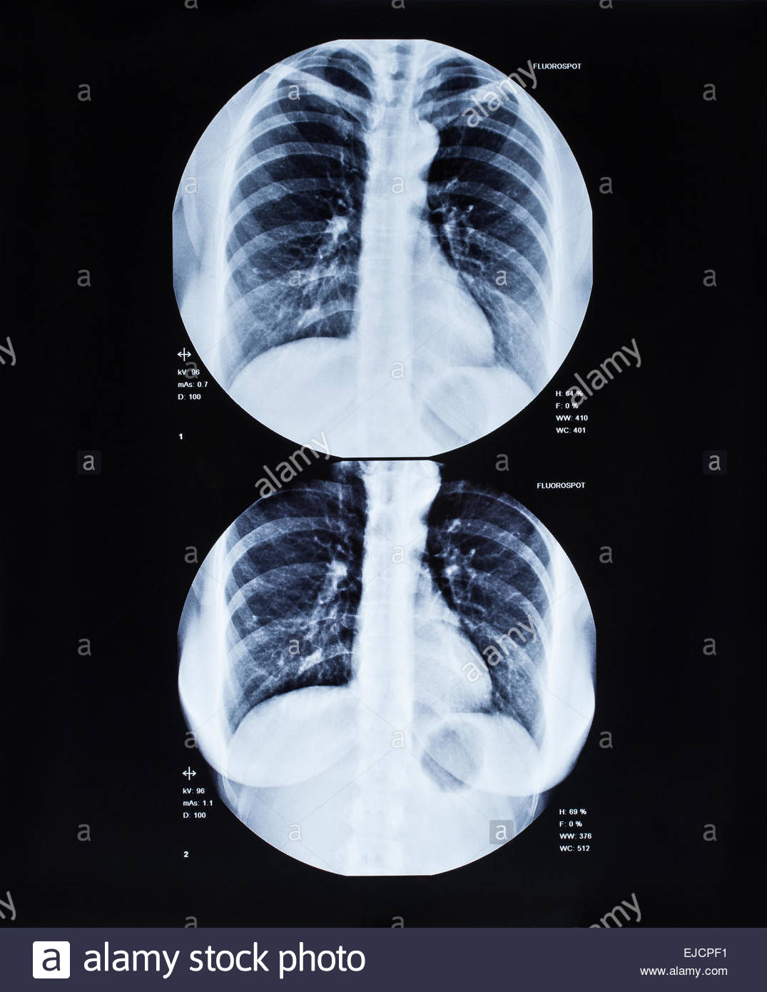 Chest Image High Resolution Stock Photography and Images - Alamy
