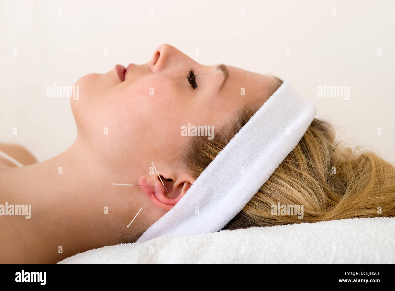 Woman on acupuncture treatment needles hi-res stock photography and ...