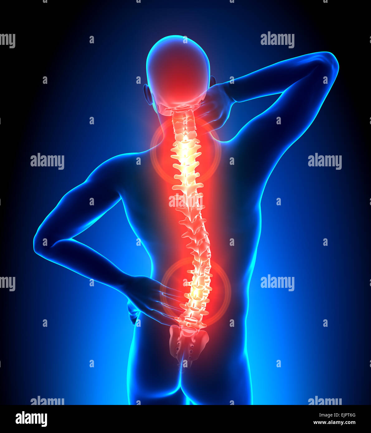 Male Spine Pain Stock Photo - Alamy