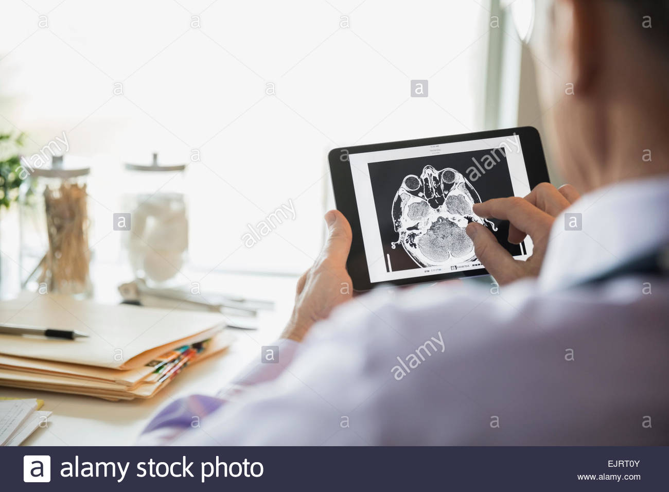 Doctor reviewing ct scan results hi-res stock photography and images ...