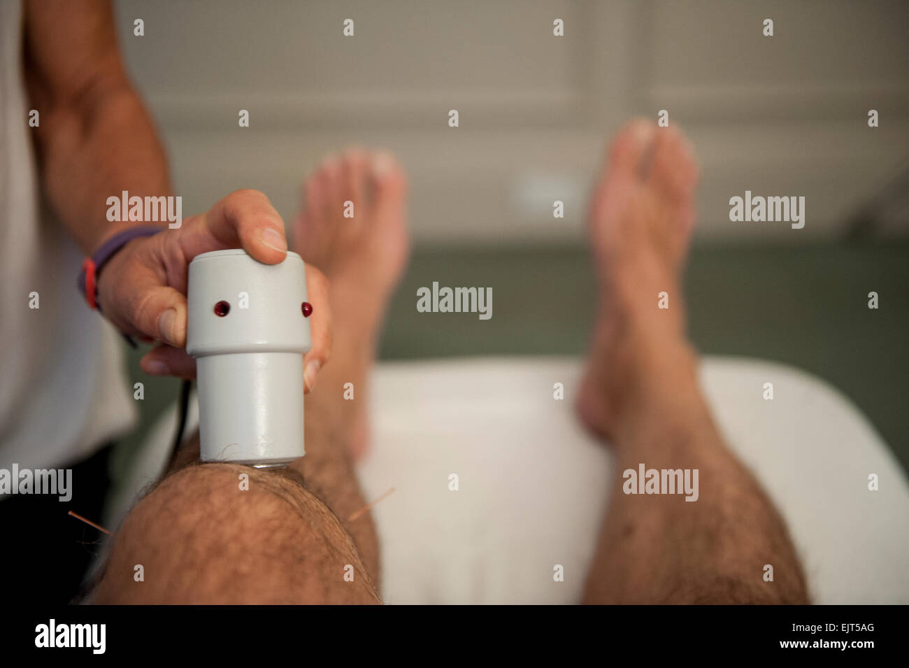 A sportsman has acupuncture needles inserted into his injured leg Stock ...