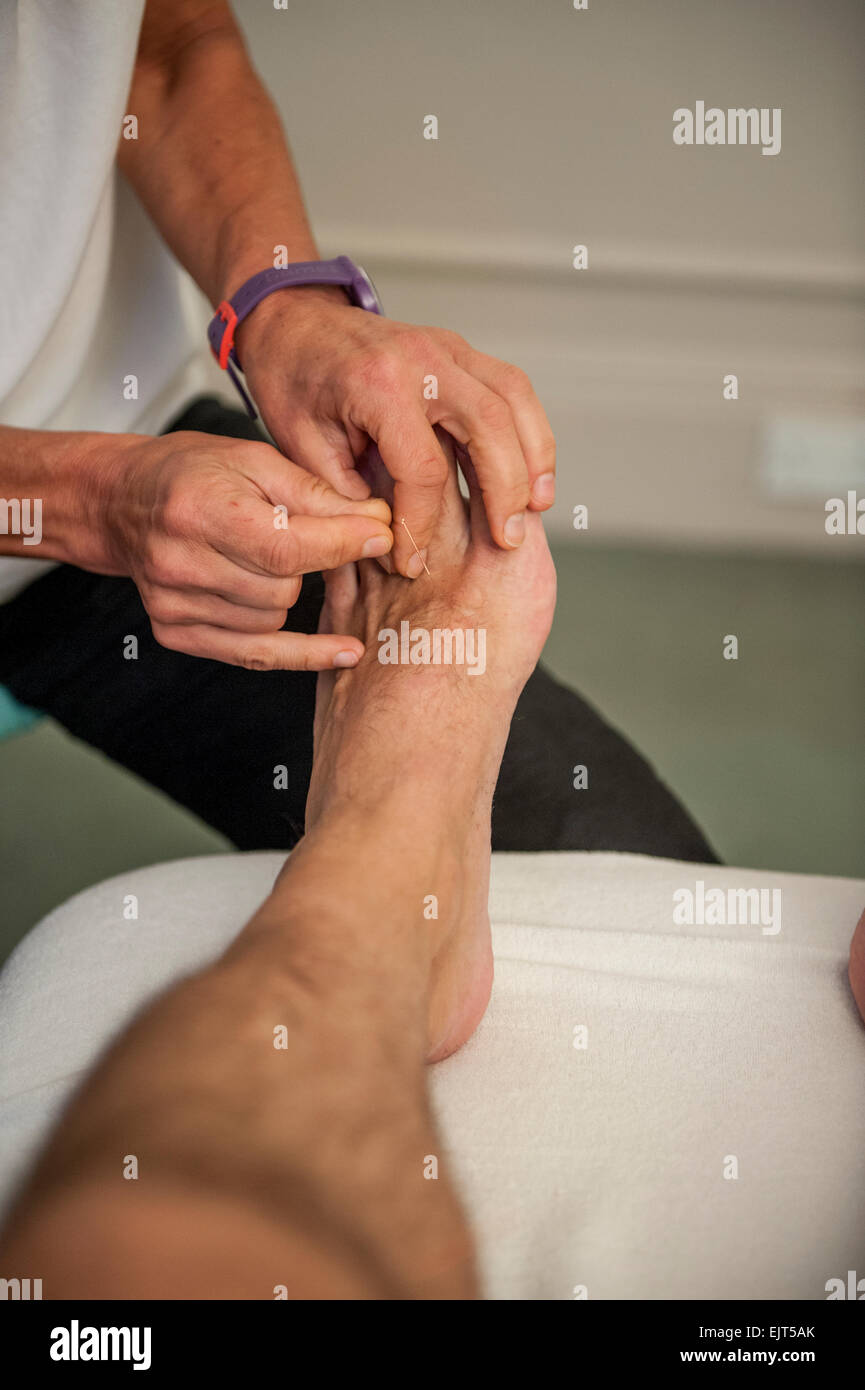 A sportsman has acupuncture needles inserted into his injured leg Stock ...