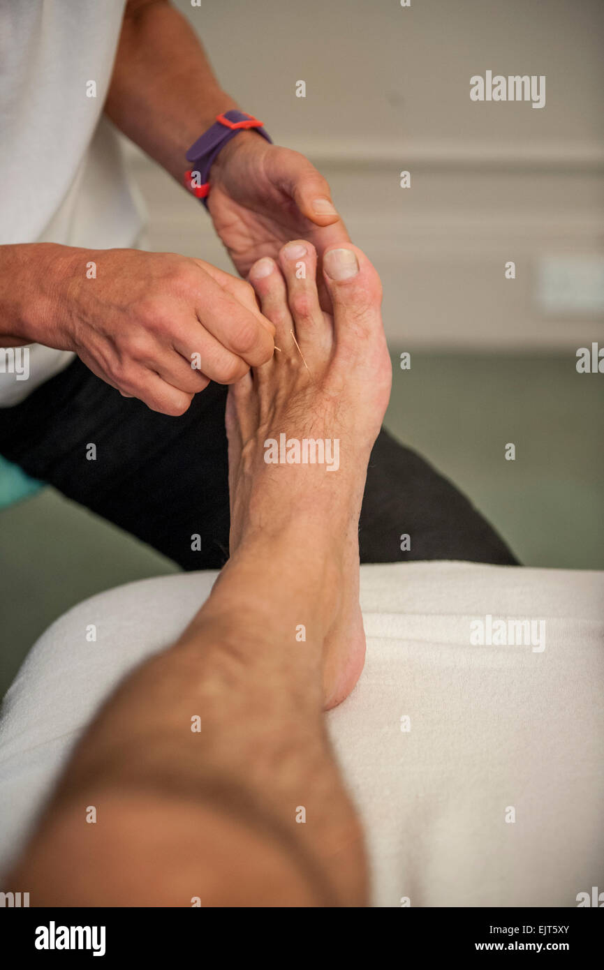 Accupuncture leg hi-res stock photography and images - Alamy