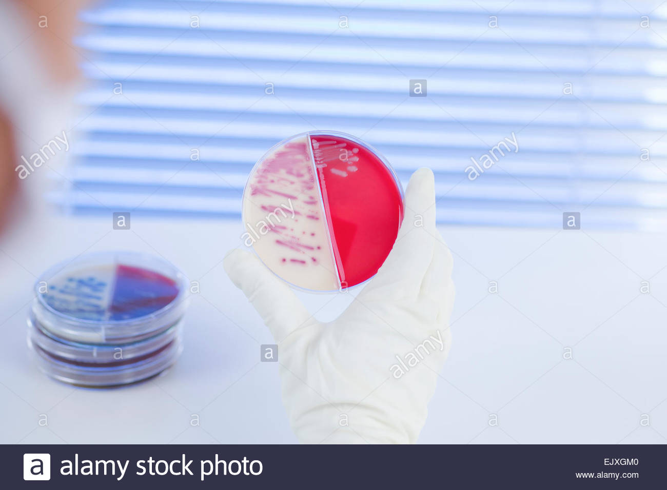 Agar Plate Stock Photos & Agar Plate Stock Images - Alamy