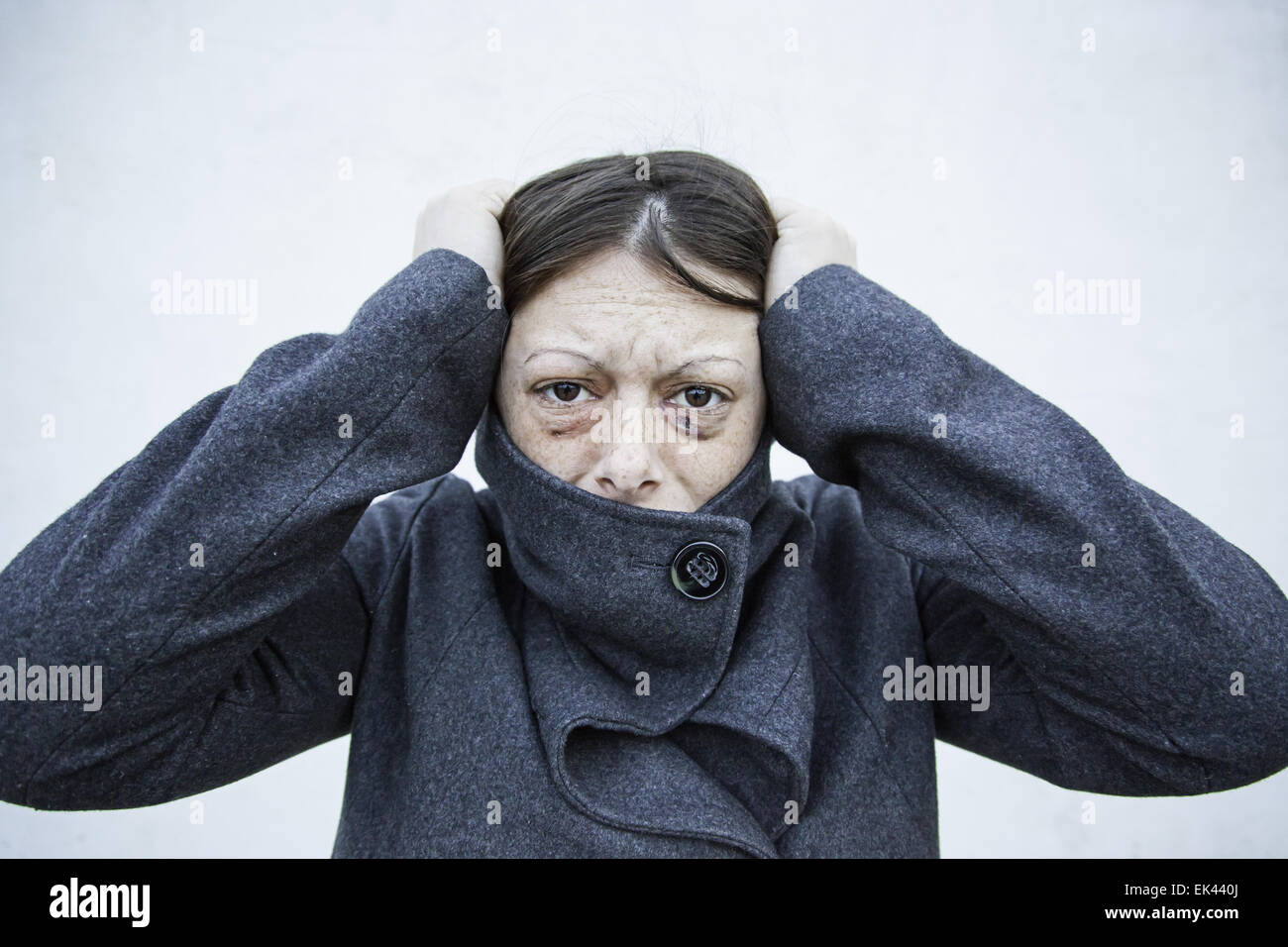 Battered woman battered woman black eye hi-res stock photography and ...