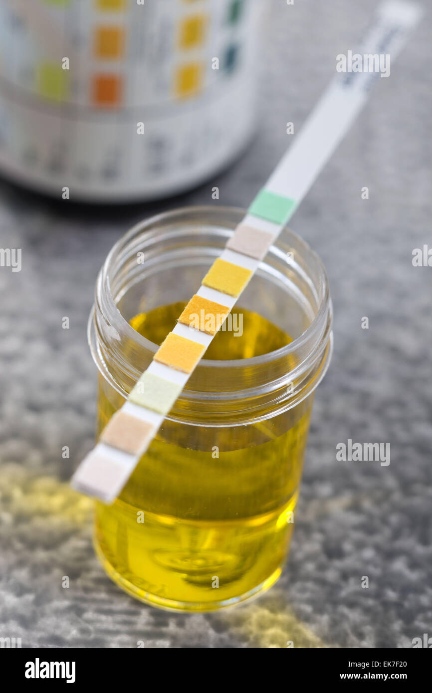 Urine test strip Stock Photo - Alamy