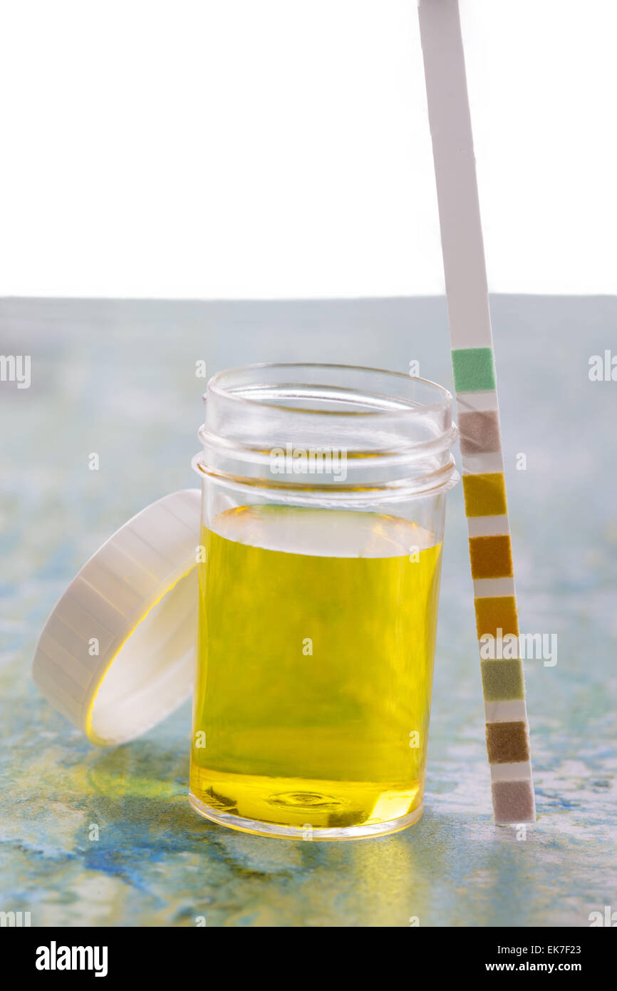 Urine test strip Stock Photo - Alamy