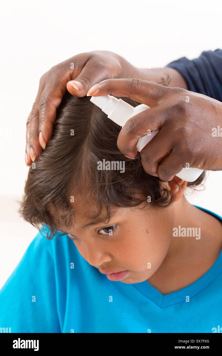 Treatment louse child Stock Photo - Alamy